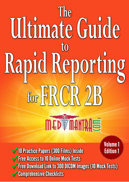 The Ultimate Guide to Rapid Reporting for FRCR 2B The Ultimate Guide to Rapid Reporting for FRCR 2B